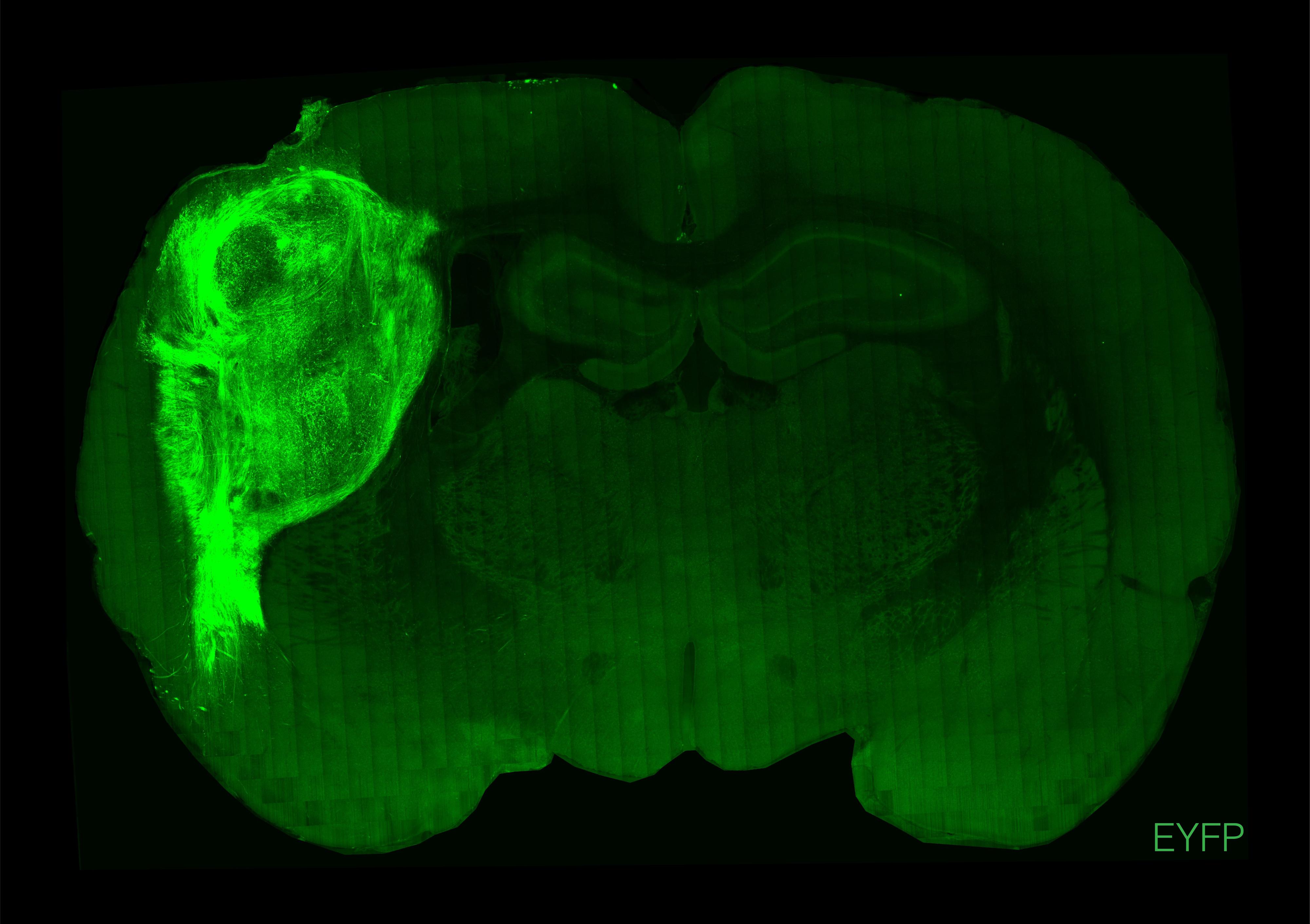 Human Neurons Grow In Rat Brains In First Human Rat Brain Hybrids